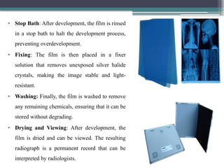 PRINCIPLES OF XRAY.pptx principle of xra | PPT