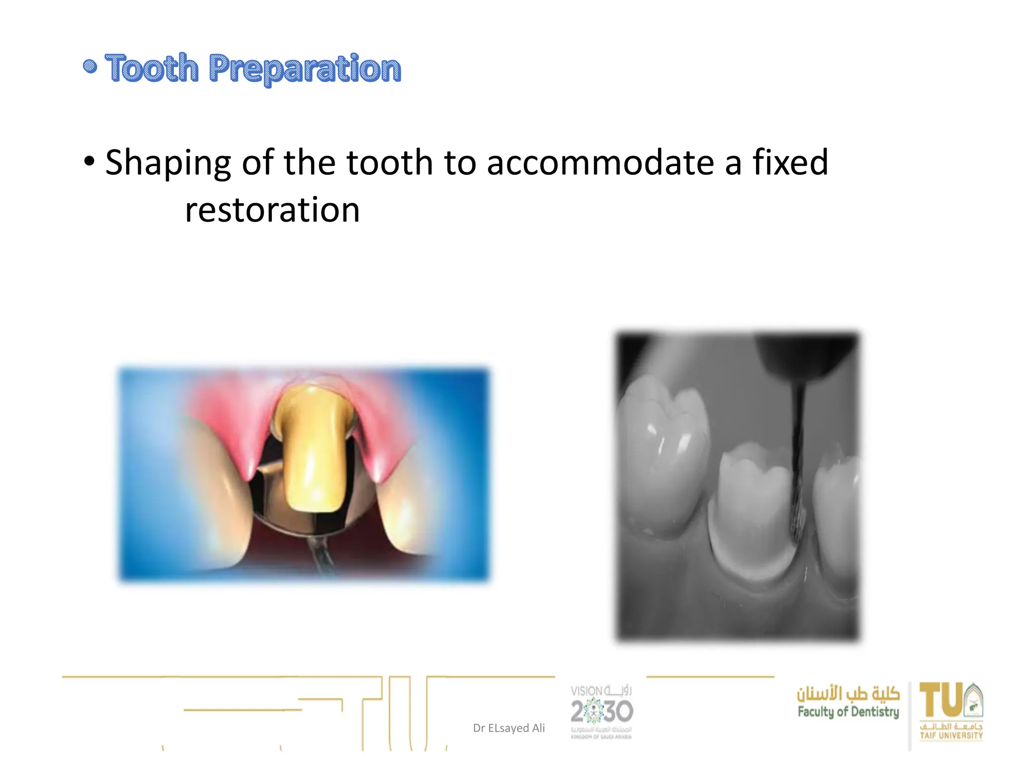 principles of tooth prep. ppt 20-21TAIF.pdf