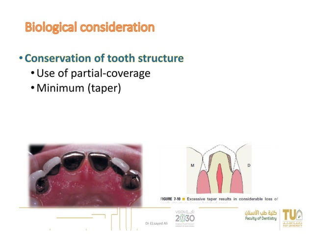 principles of tooth prep. ppt 20-21TAIF.pdf