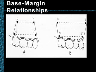 Principles of oral surgery | PPT