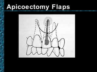 Principles of oral surgery | PPT