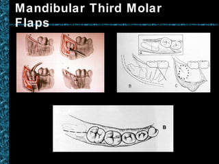 Principles of oral surgery | PPT