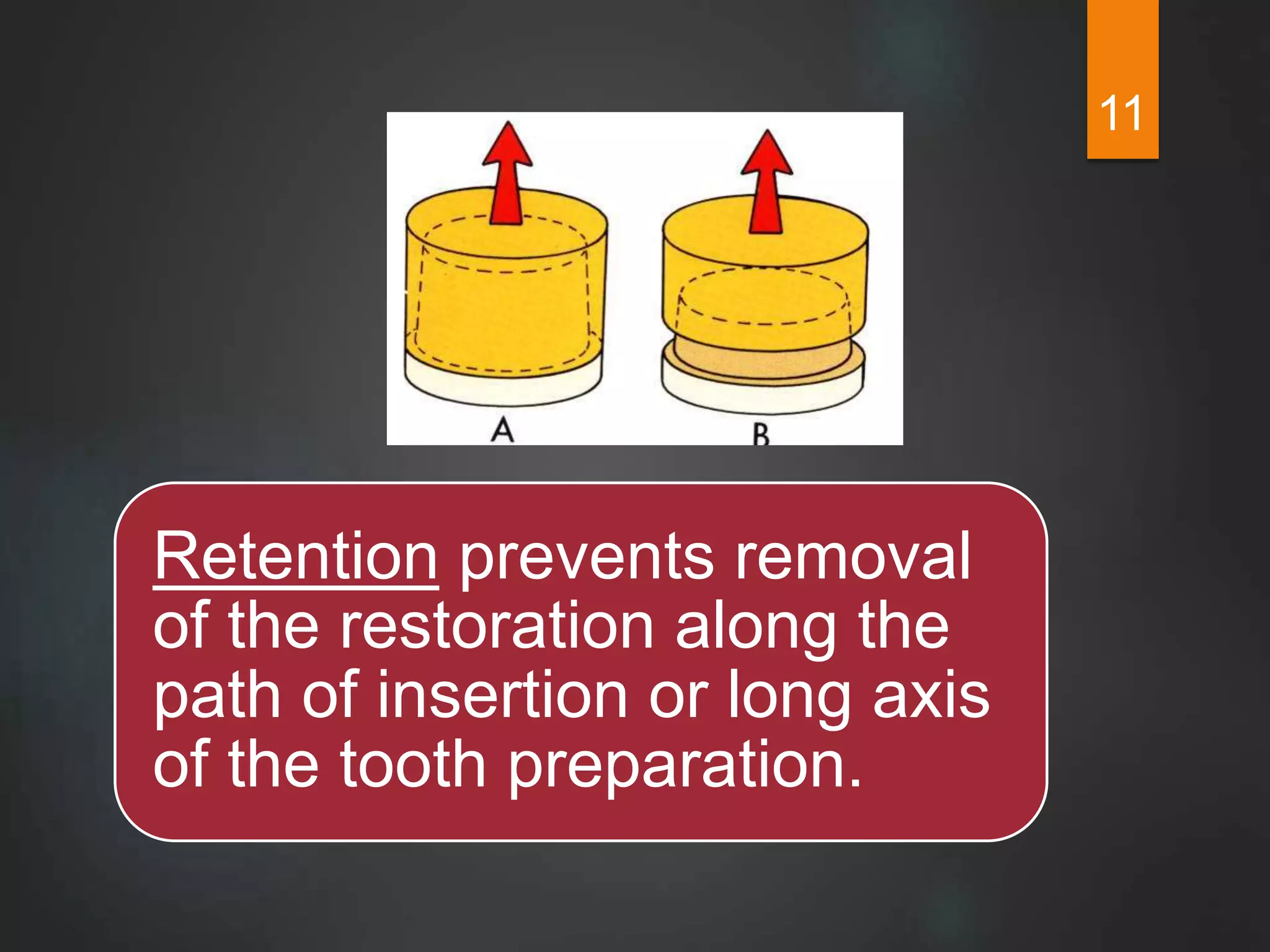 Principles of tooth preparation devi | PPTX
