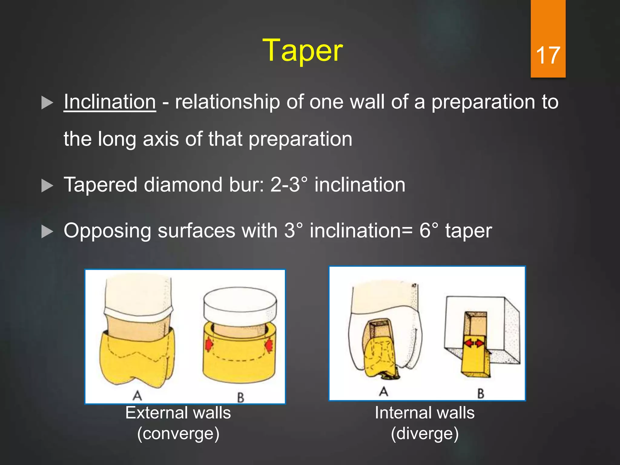 Principles of tooth preparation devi | PPTX