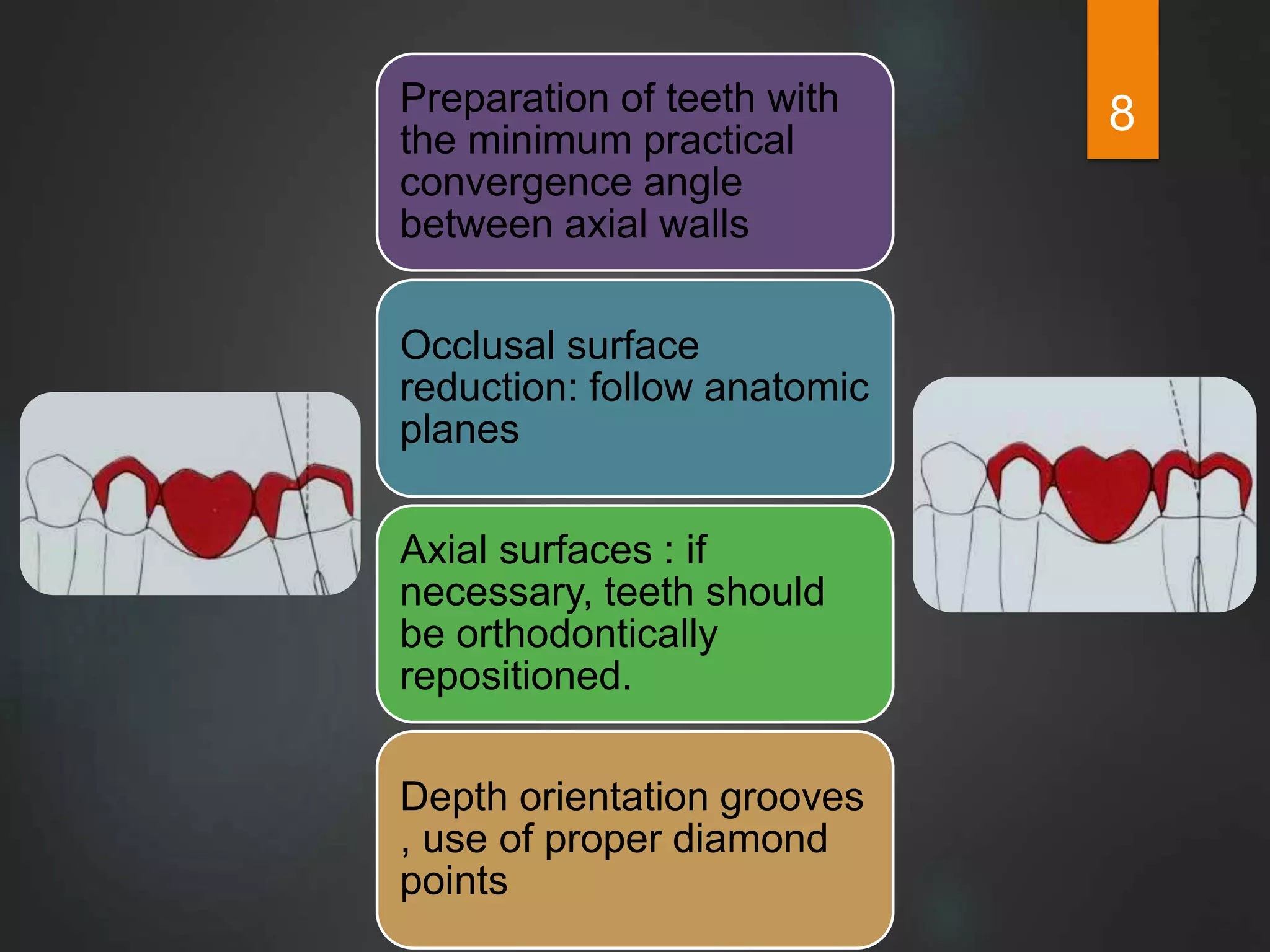 Principles of tooth preparation devi | PPTX