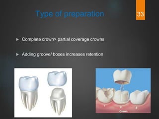 Principles of tooth preparation devi | PPTX
