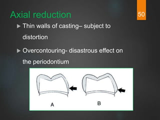 Principles of tooth preparation devi | PPTX