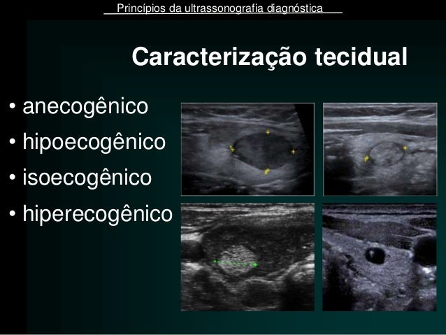 Princípios de física aplicada à ultrassonografia