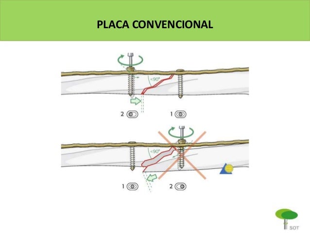 Princípios de osteossíntese 2016