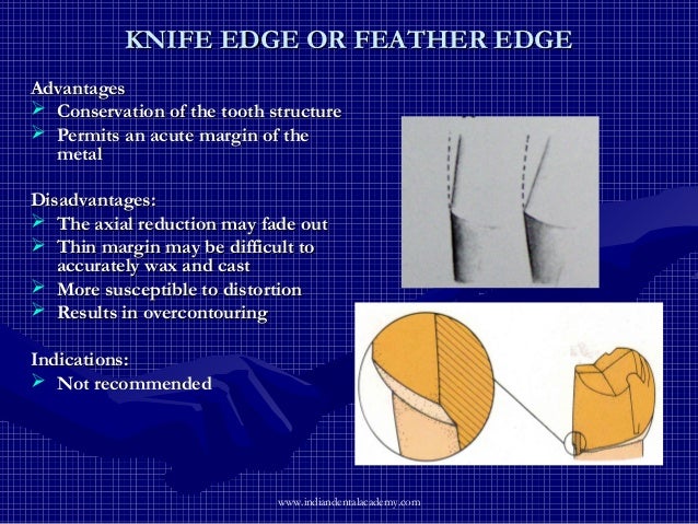 Princples of tooth preparation / dental crown & bridge courses