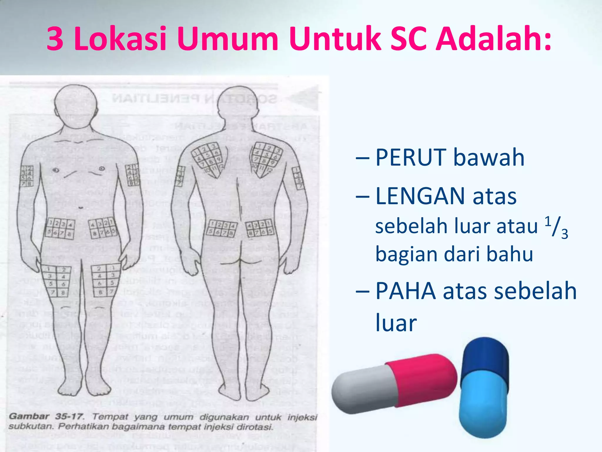 Prinsip dan tehnik pemberian obat subcutan dan intracutan | PPTX