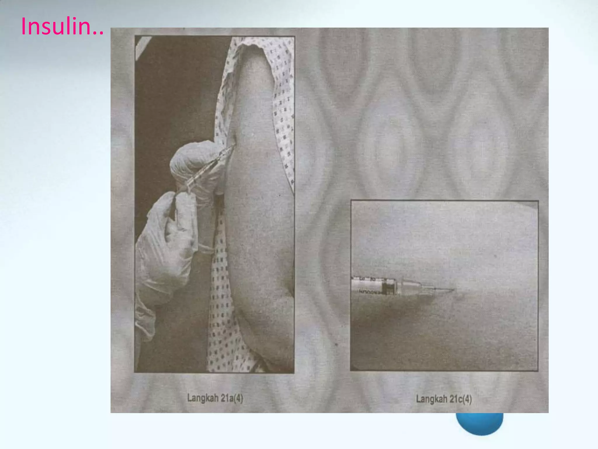 Prinsip dan tehnik pemberian obat subcutan dan intracutan | PPTX