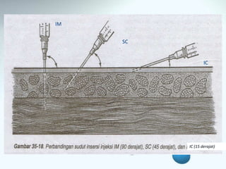 Prinsip dan tehnik pemberian obat subcutan dan intracutan | PPTX