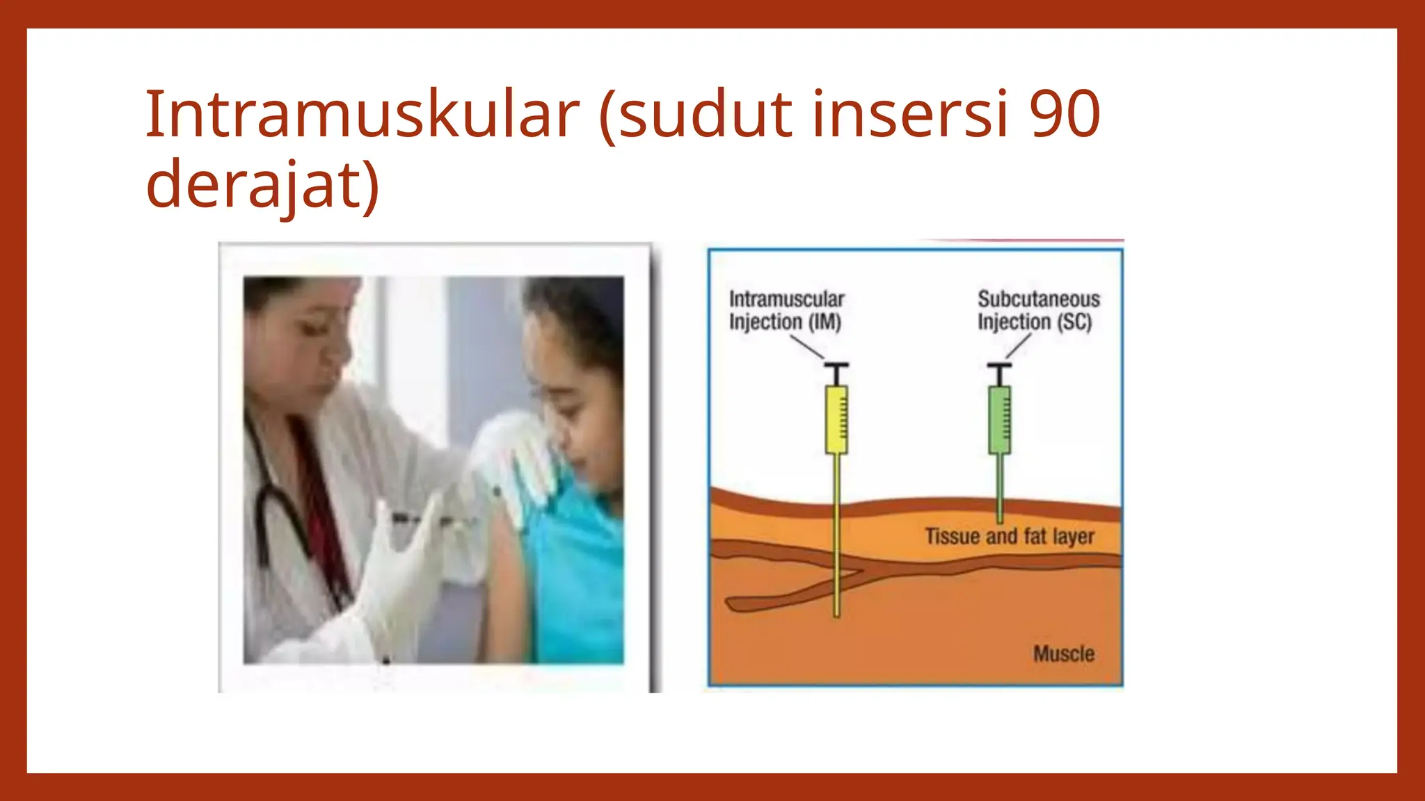 Prinsip dan teknik pemberian obat parenteral.pptx
