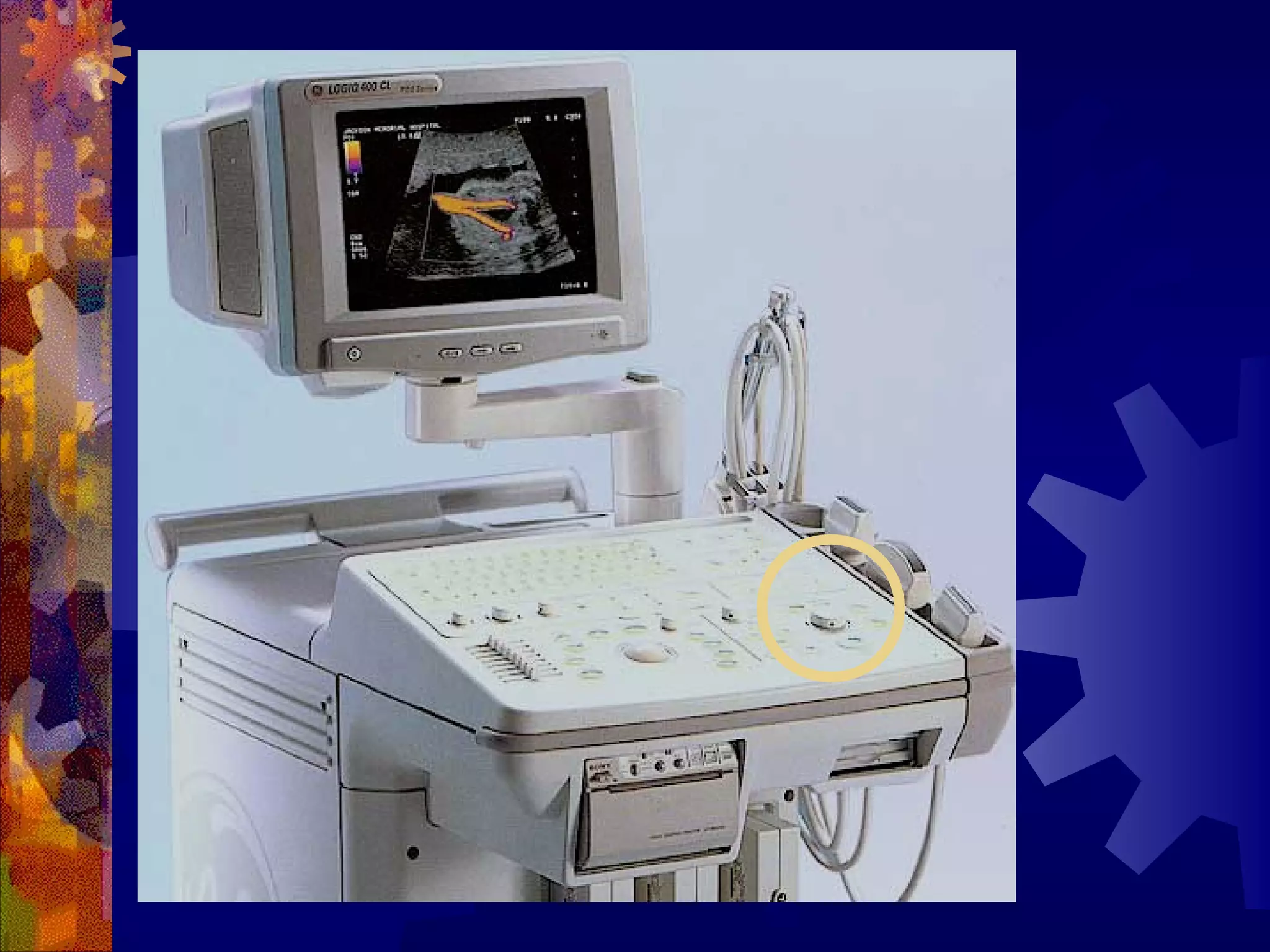 Prinsip dasar usg | PPT