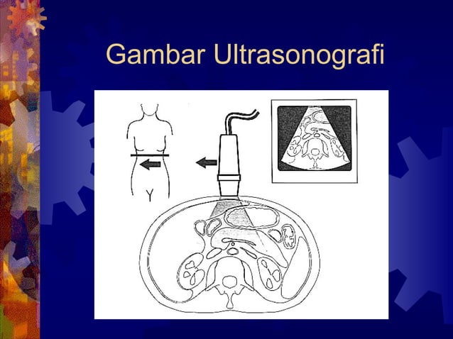 Prinsip dasar usg | PPT