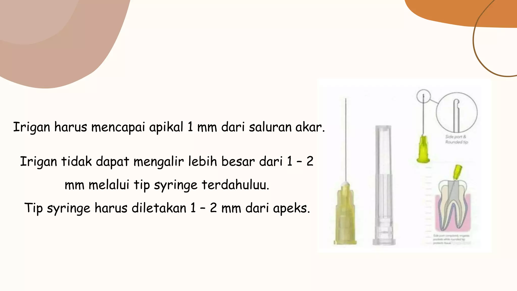 prinsip endodontik preparasi.pptx
