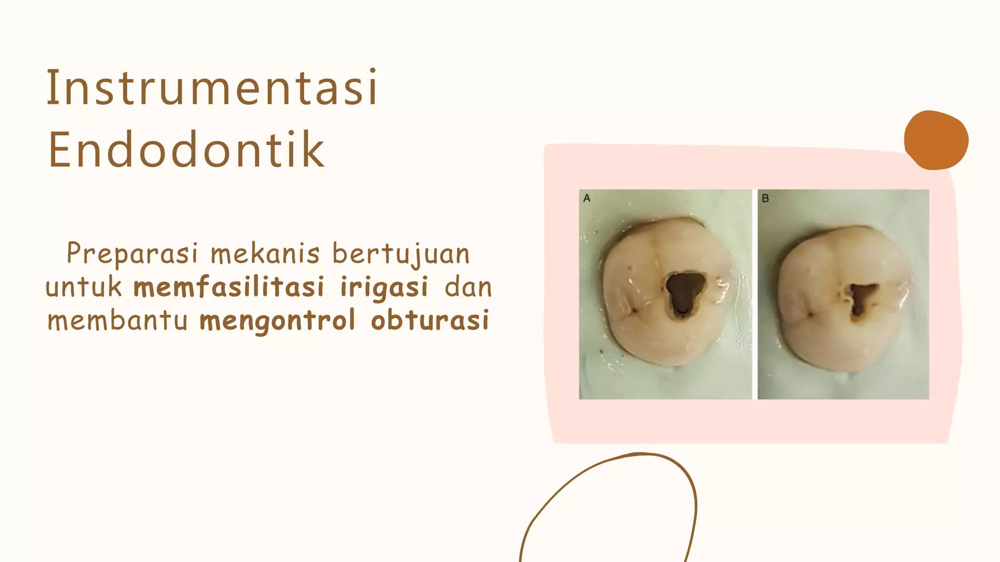 prinsip endodontik preparasi.pptx
