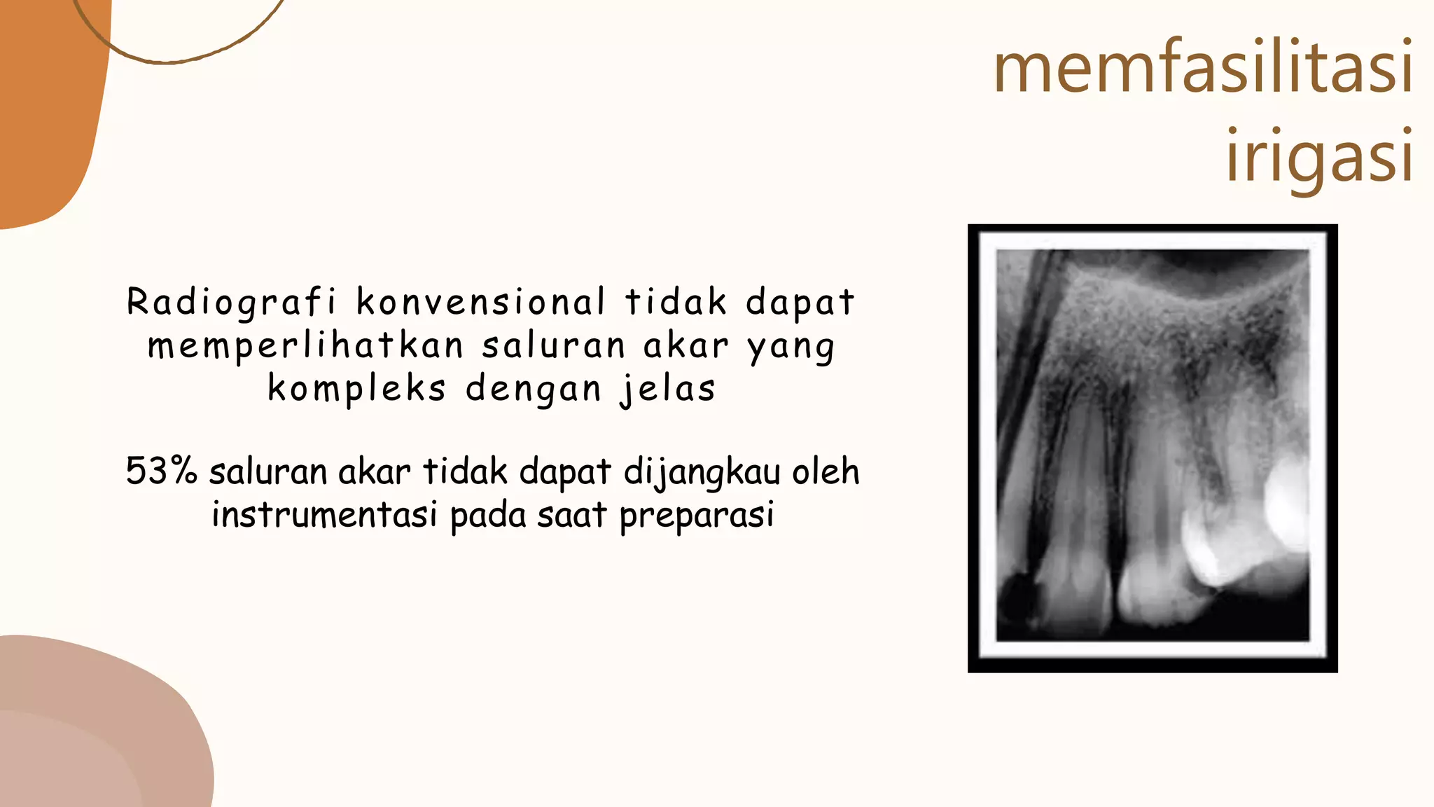 prinsip endodontik preparasi.pptx
