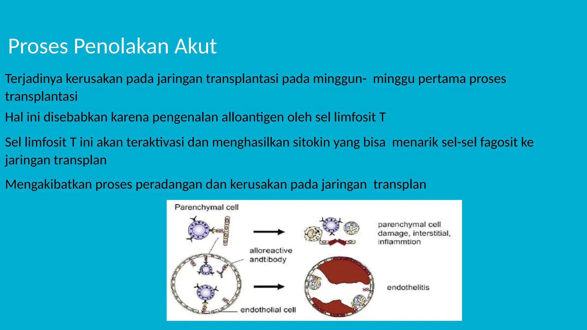 Prinsip Imunologi Transplantasi (Respon Imun terhadap Allograft, Mekanisme dan Pola Penolakan ...