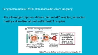 Prinsip Imunologi Transplantasi (Respon Imun terhadap Allograft, Mekanisme dan Pola Penolakan ...