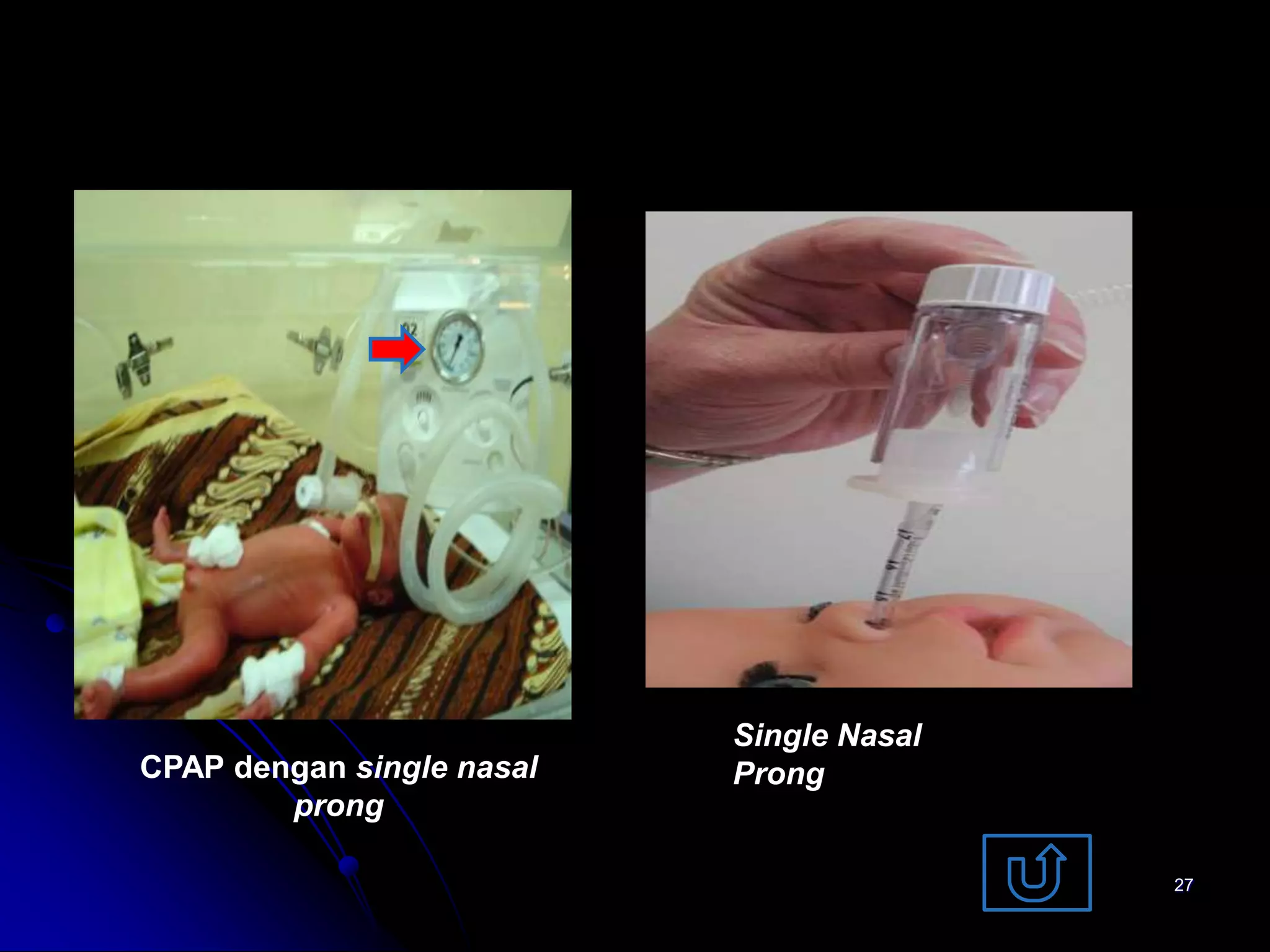 Prinsip rujukan neonatus.ppt