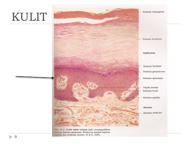 perubahan pada kulit yang bersifat progresif (modul kulit dan jaringa…