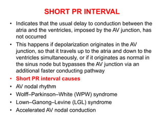 PR INTERVAL,CAUSES OF SHORT AND LONG PR INTERVAL | PPTX