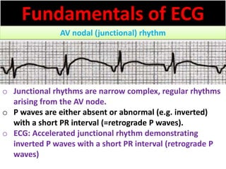 Prolonged Pr Interval