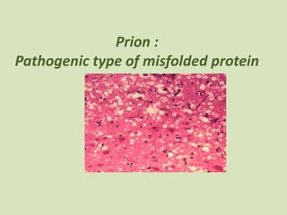 Prion : PATHOGENTIC TYPES OF MISFOLD PROTEIN | PPT