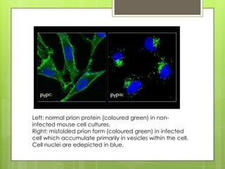 Prion disease | PPT