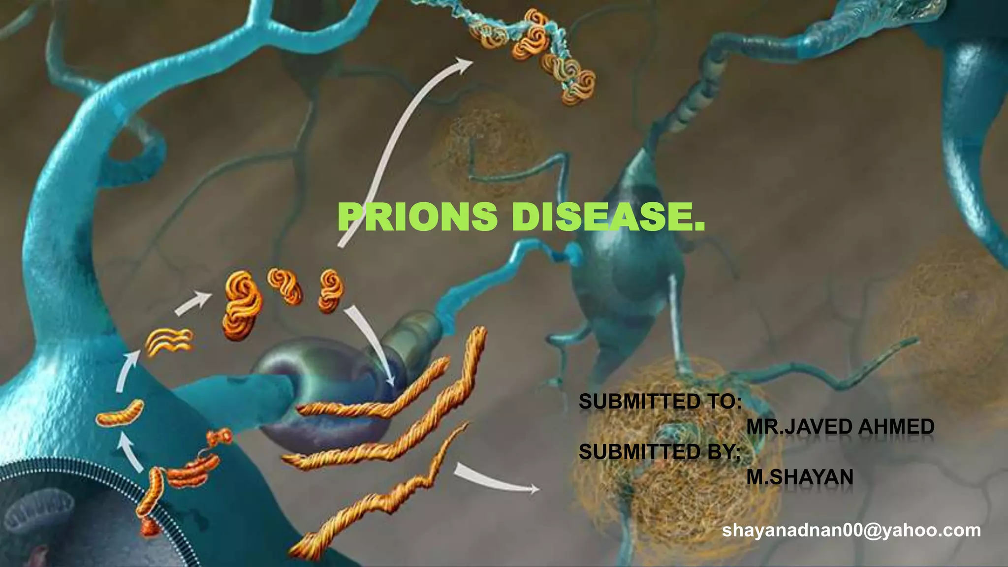 Prion disease | PPT