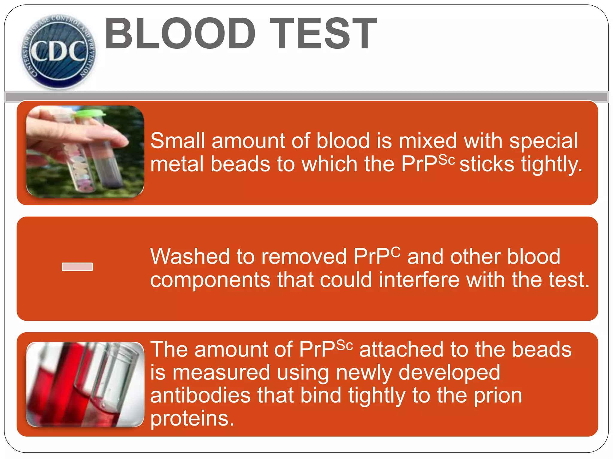 Prion diseases | PPTX