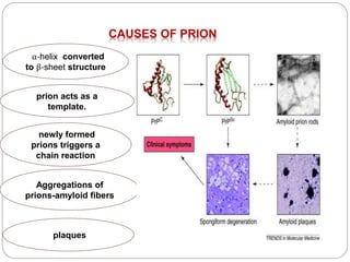 Prion diseases | PPTX