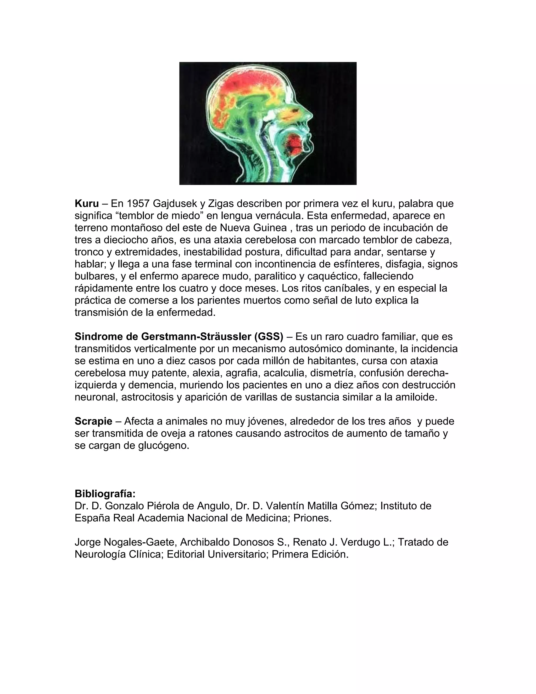 Priones | DOC