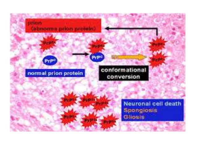 Prions | PPTX