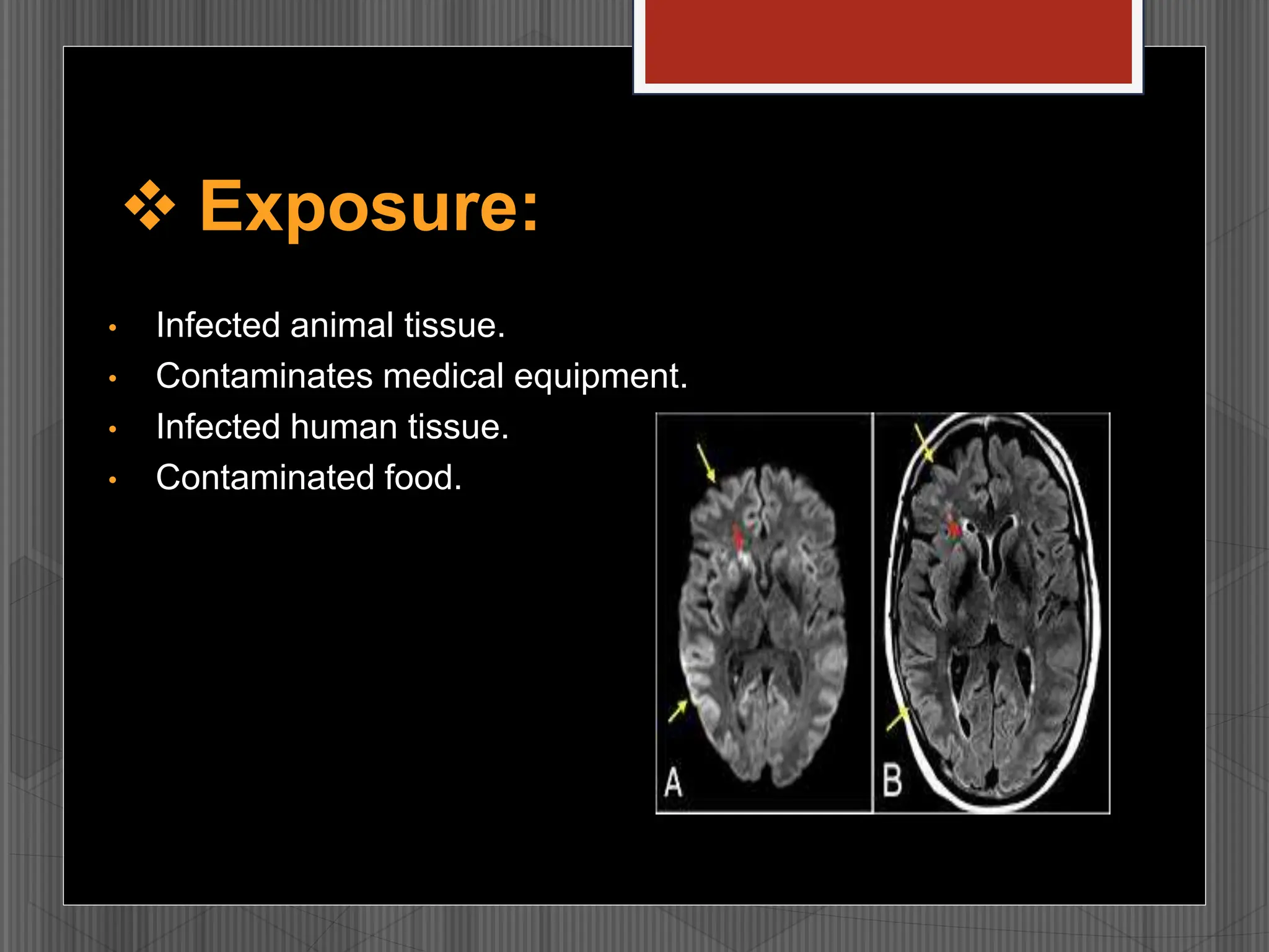 prions,types, disease, prevention and treatment | PPTX