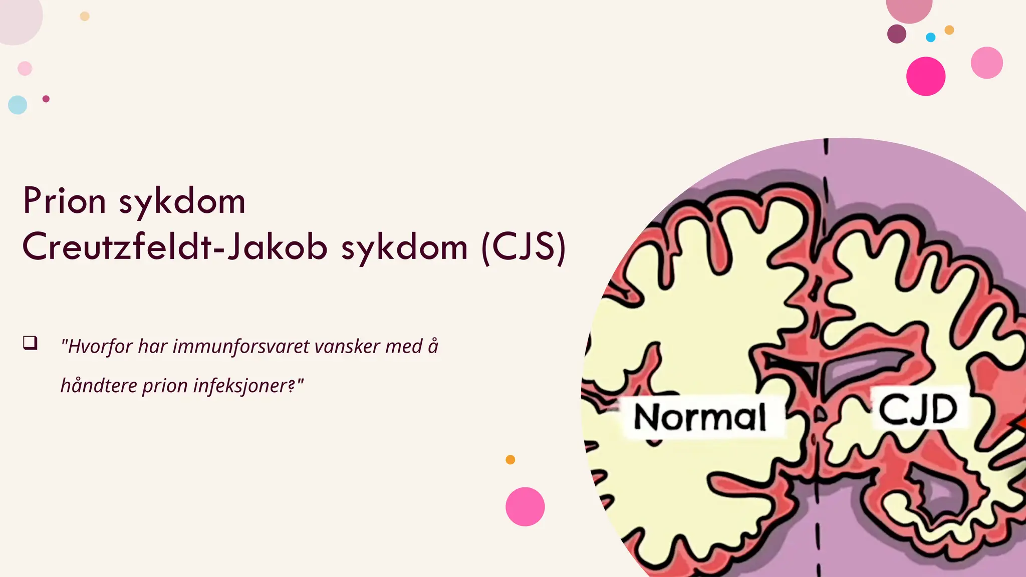 Prion disease presentation in norwegian- CJS.pptx
