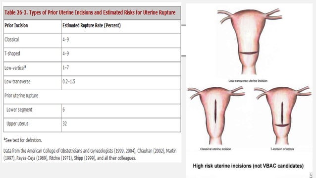 Prior cesarean delivery (VBAC) | PPT