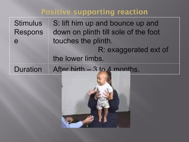 PRI REFLEXES TIPS AND TRICKS DEVELOPMENTAL.ppt