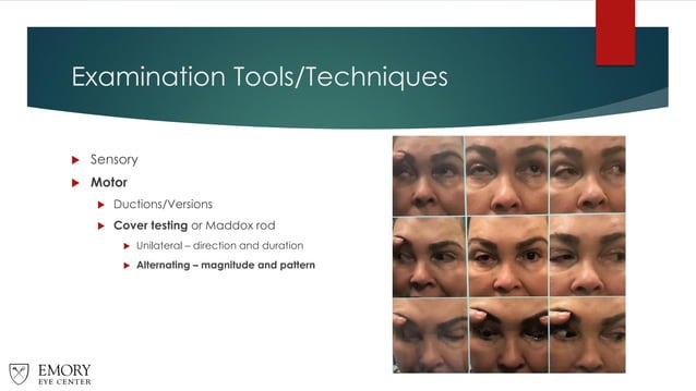 Prism for-diplopia cybersight | PDF | Eye and Vision Conditions ...