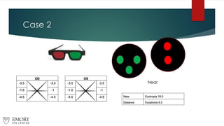 Prism for-diplopia cybersight | PDF