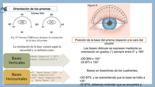 prismas oftalmicas en la practica de oftalmologia | PPTX