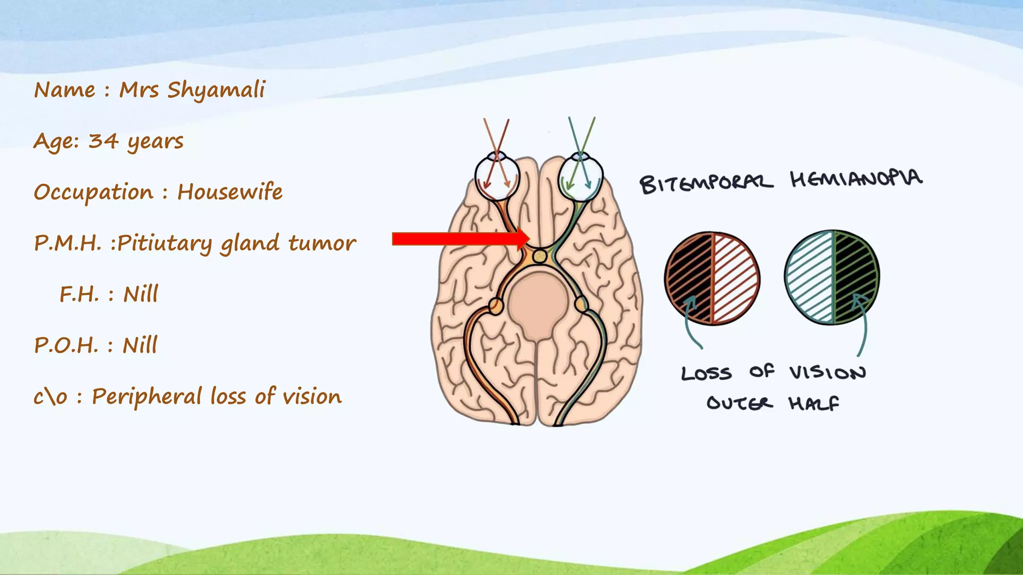 Optometry with Prism | PDF | Eye and Vision Conditions | Diseases and ...