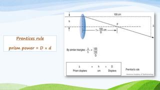 Optometry with Prism | PDF | Eye and Vision Conditions | Diseases and ...