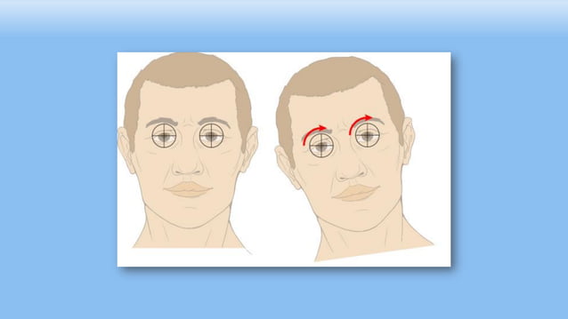 Optometry with Prism | PDF | Eye and Vision Conditions | Diseases and ...