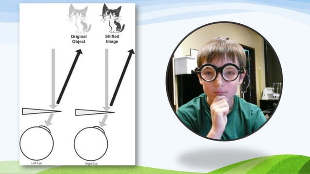 Optometry with Prism | PDF | Eye and Vision Conditions | Diseases and ...