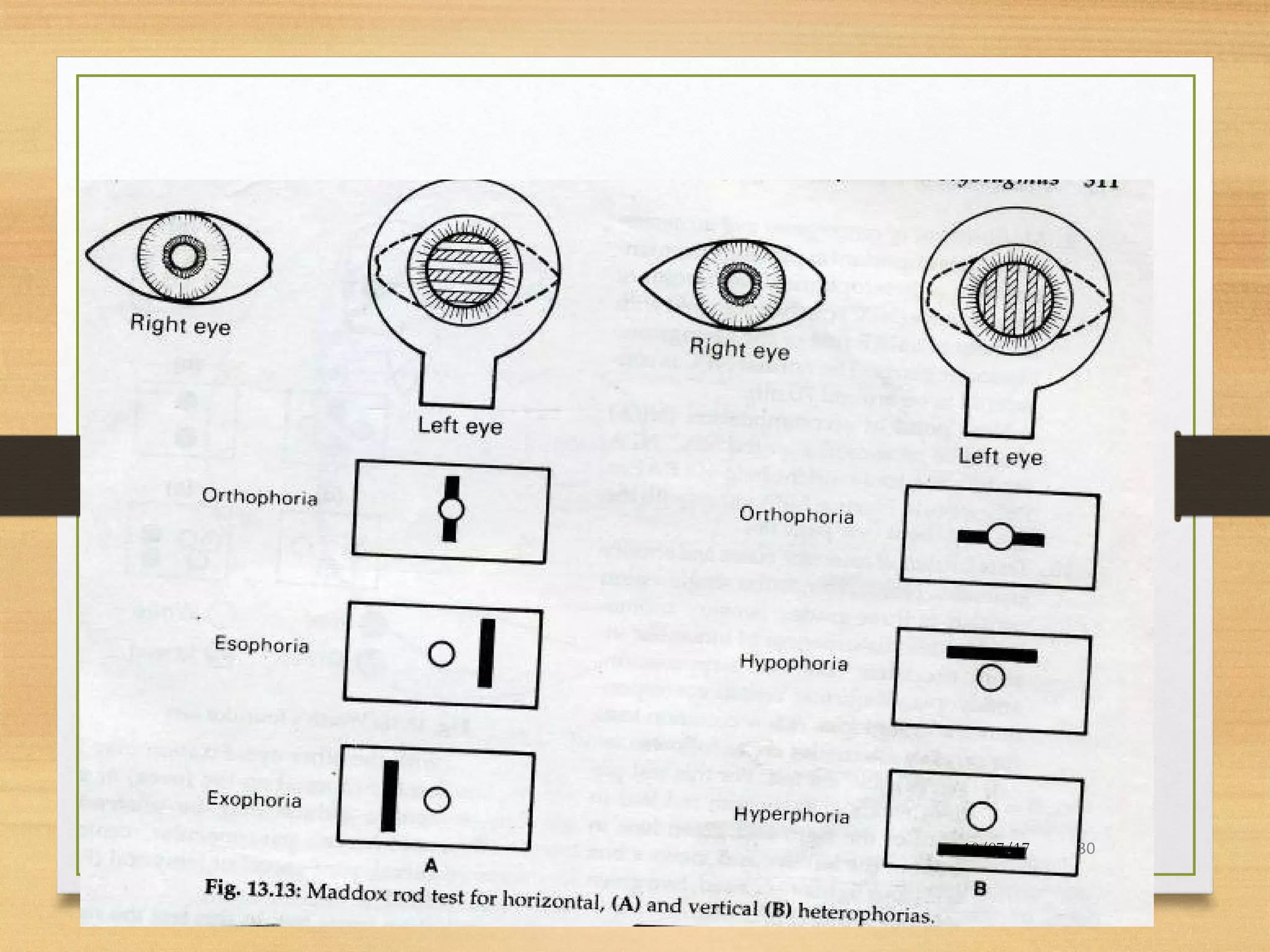 Prisms in optometry practice | PPT