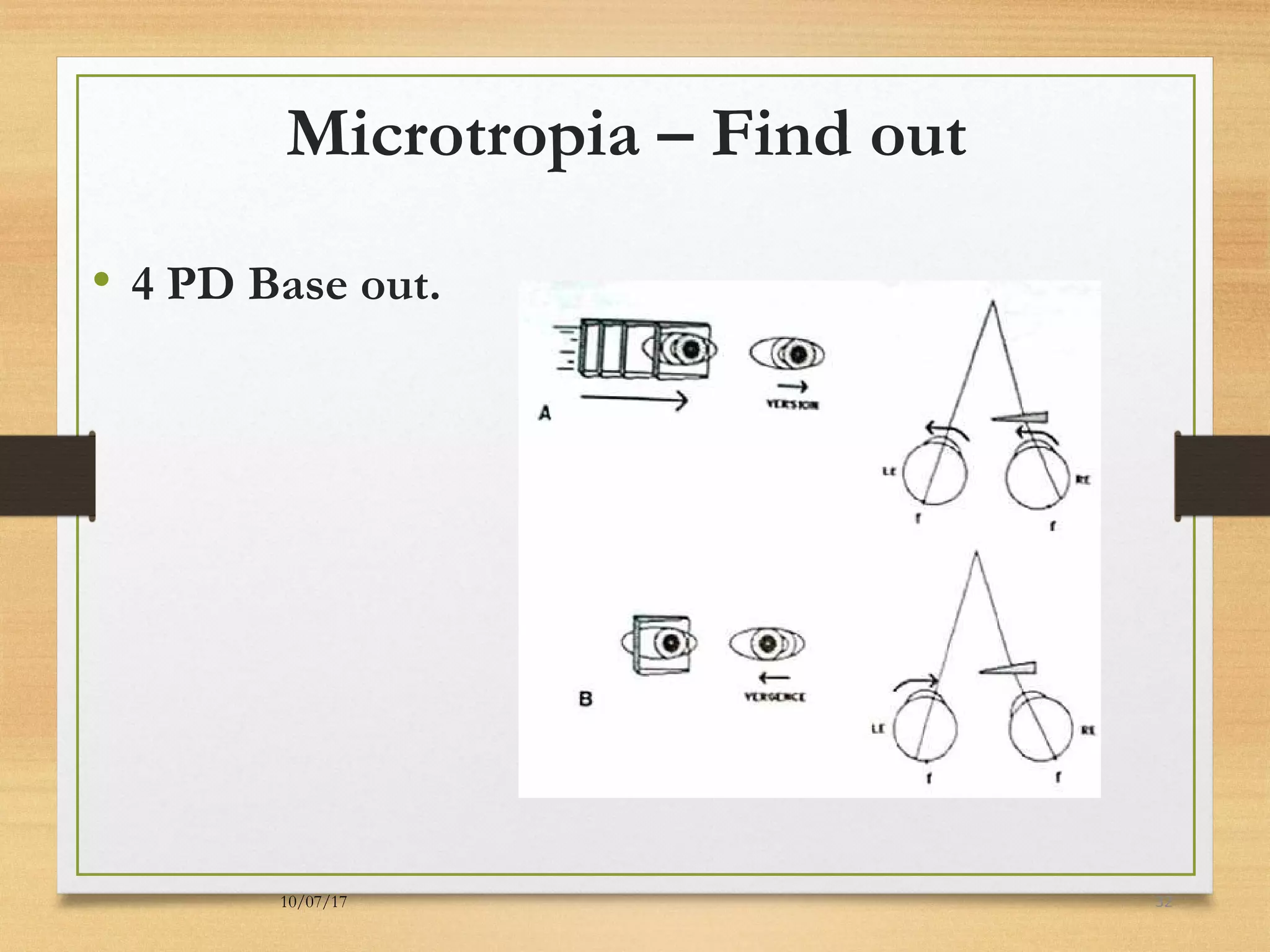 Prisms in optometry practice | PPT