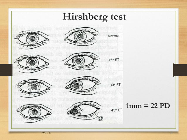 Prisms in optometry practice | PPT | Eye and Vision Conditions ...